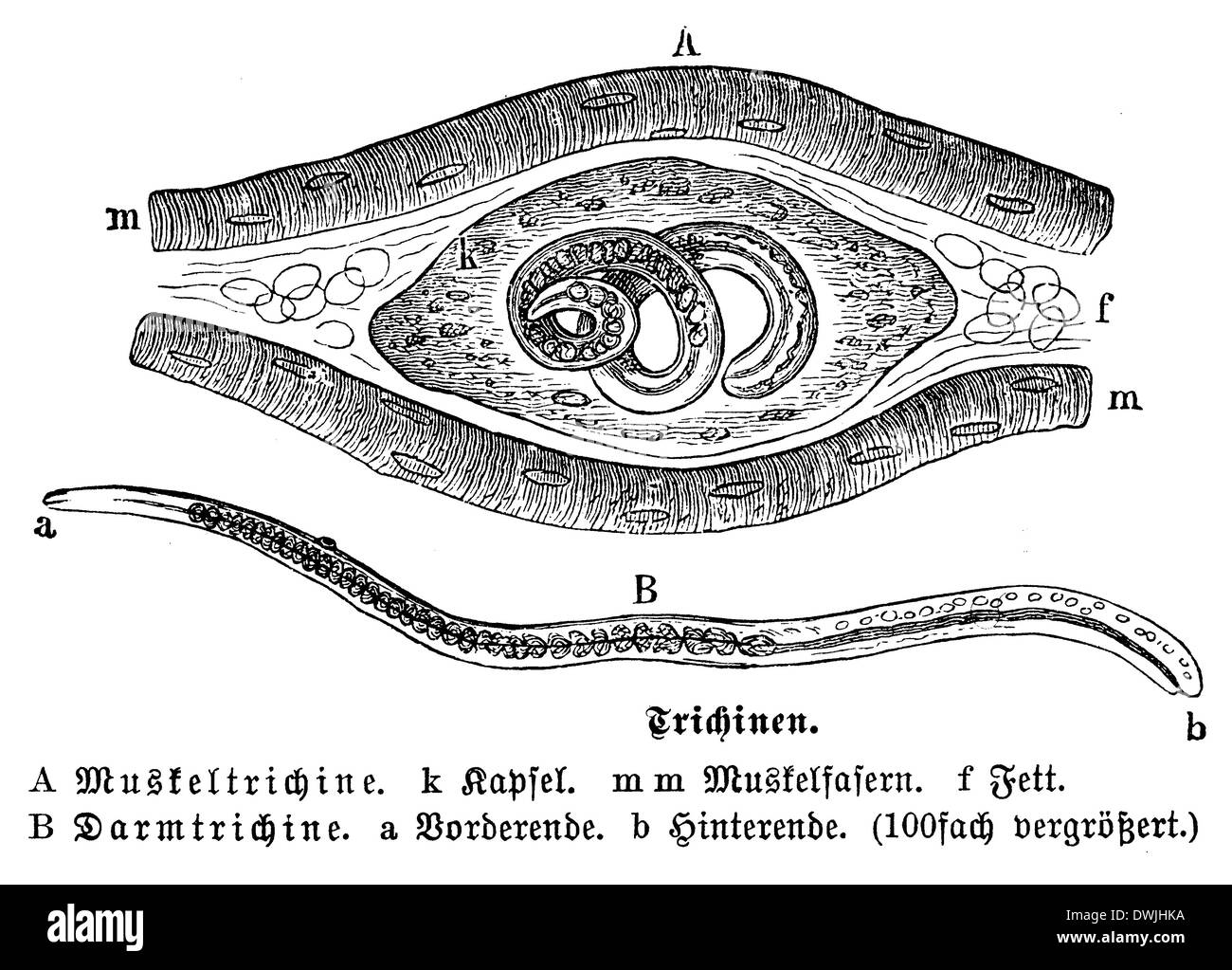 Trichina spiralis hi-res stock photography and images - Alamy
