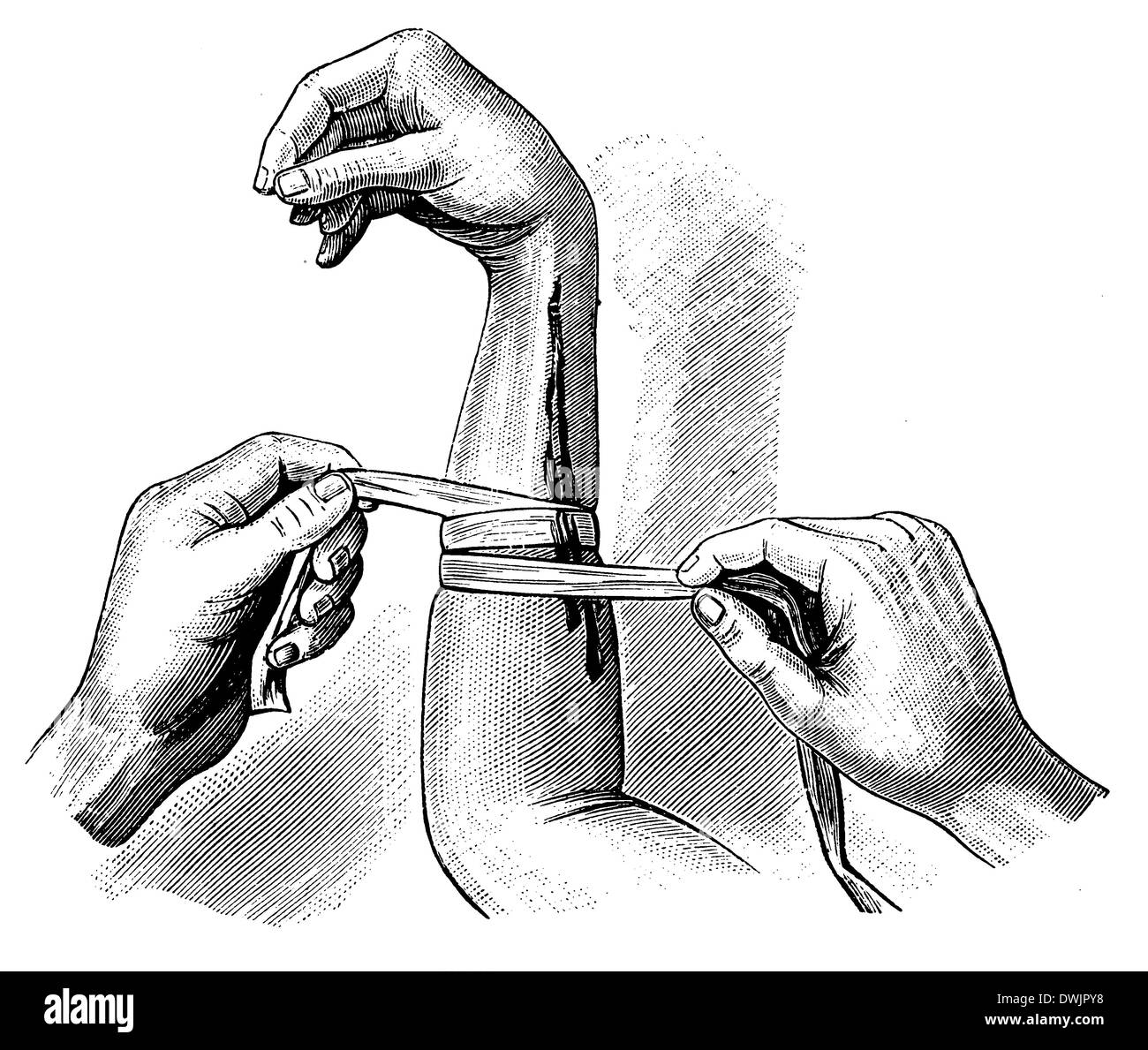 Blutung hi-res stock photography and images - Alamy