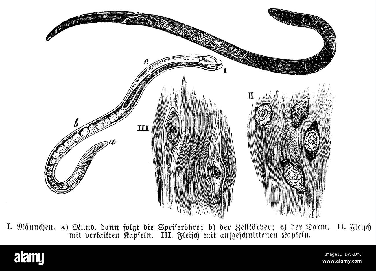 Trichina spiralis hi-res stock photography and images - Alamy