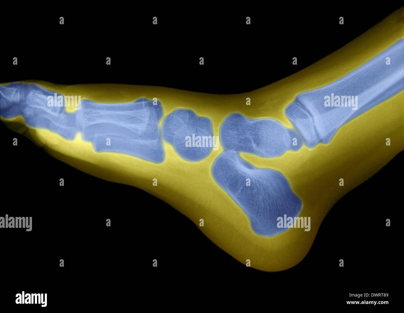 Cuboid profile hi-res stock photography and images - Alamy