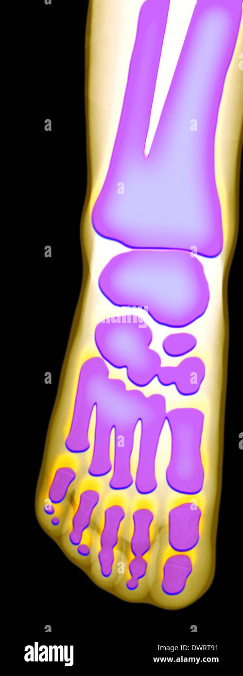 Foot x ray Stock Photo - Alamy