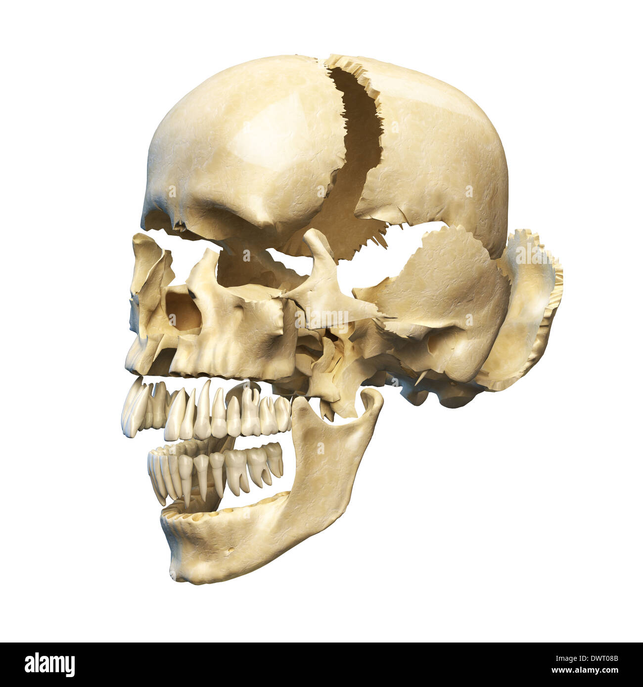 Human skull with parts exploded. Perspective view, on white background ...