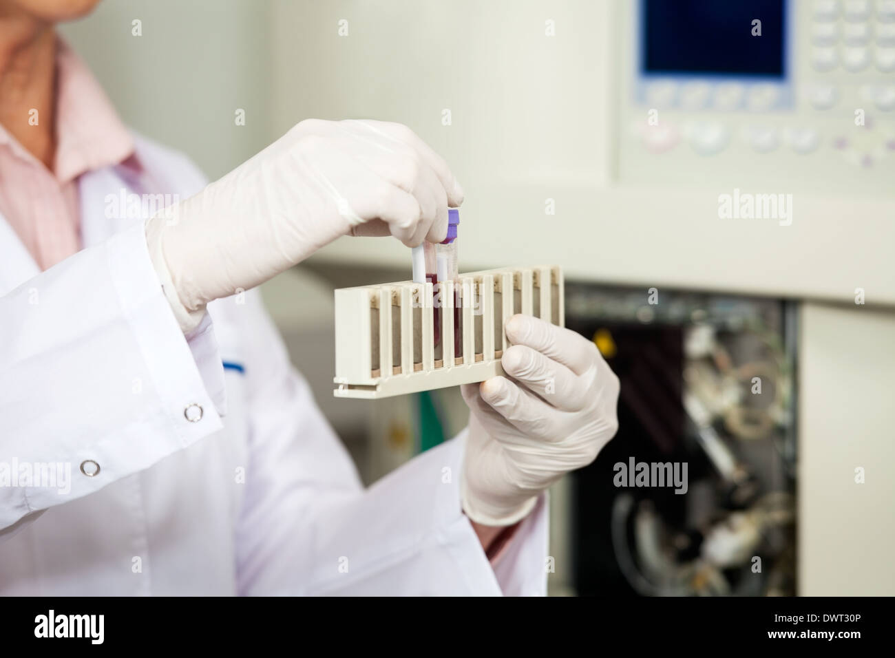 Female Medical Worker Analyzing Blood Samples Stock Photo - Alamy
