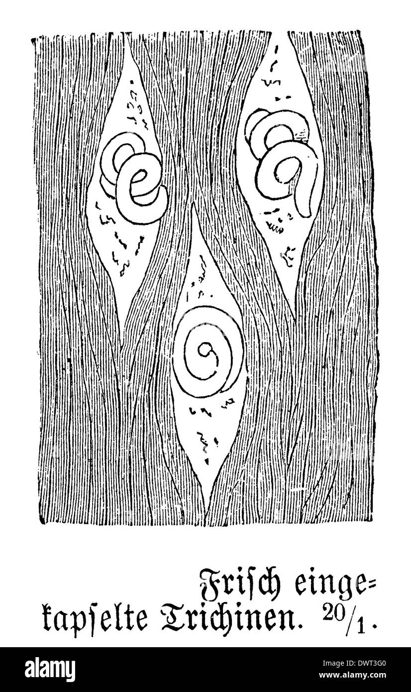 Trichina High Resolution Stock Photography and Images - Alamy