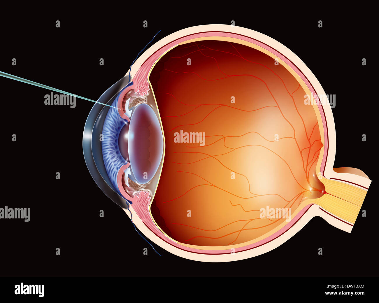 Iridotomy hi-res stock photography and images - Alamy
