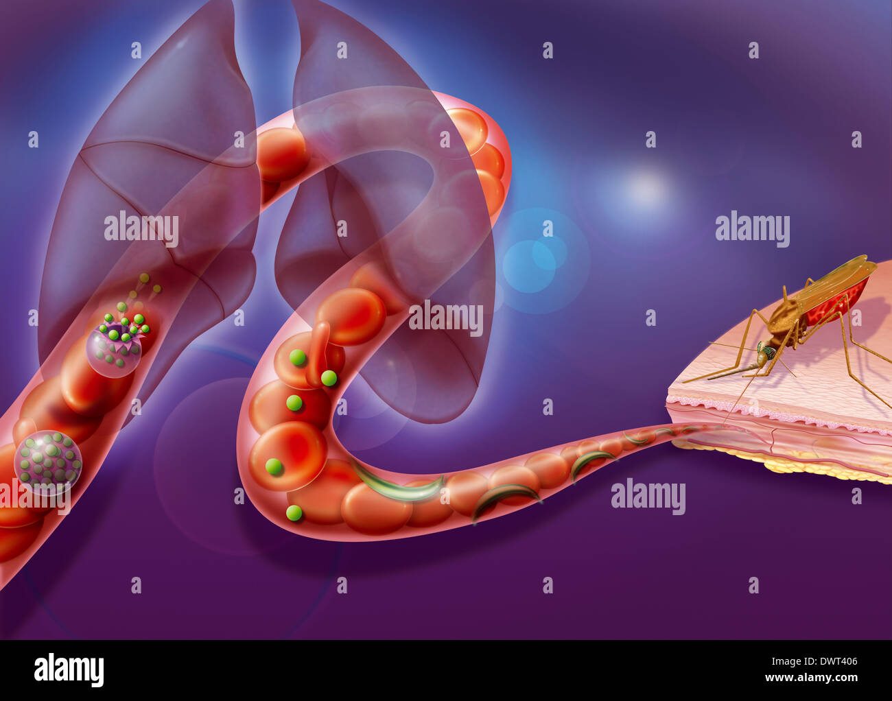 Malaria parasite hi-res stock photography and images - Alamy