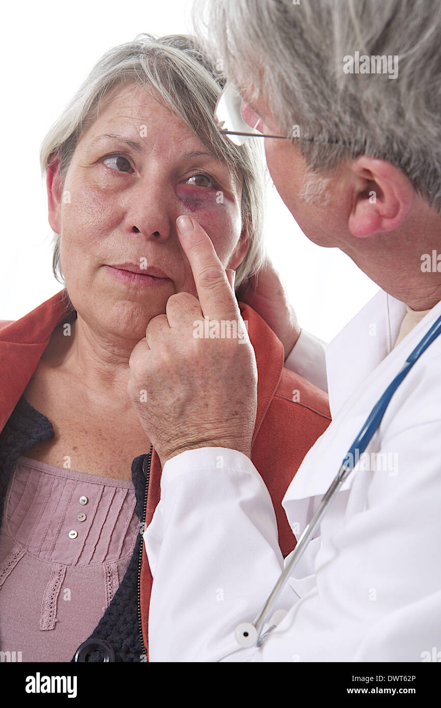 Traumatic hematoma hi-res stock photography and images - Alamy