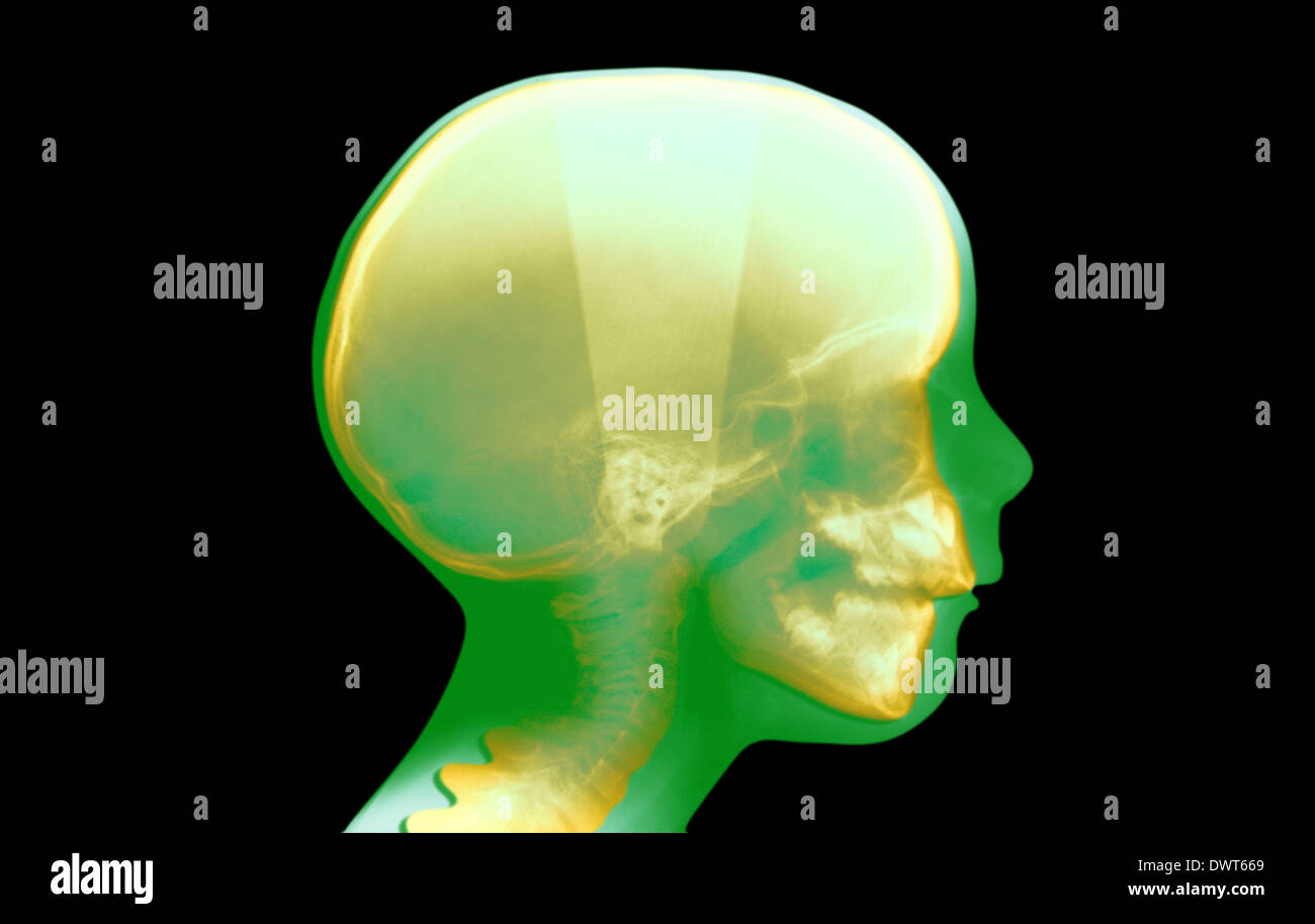 Retrogenia hi-res stock photography and images - Alamy