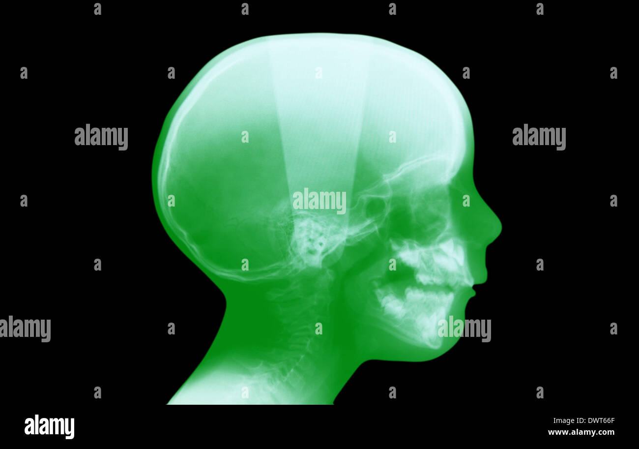 Retrogenia hi-res stock photography and images - Alamy