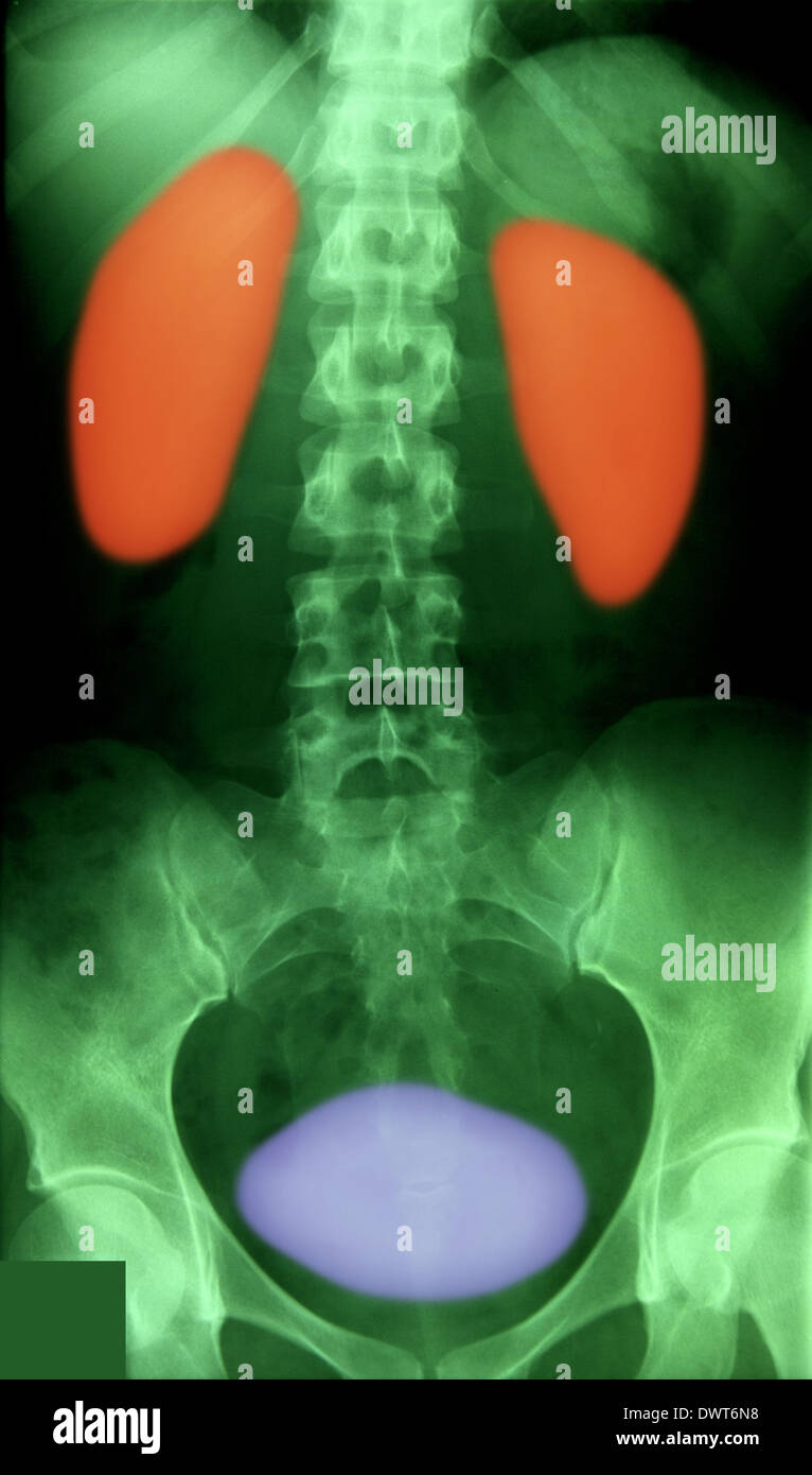 Urinary system x ray Stock Photo - Alamy