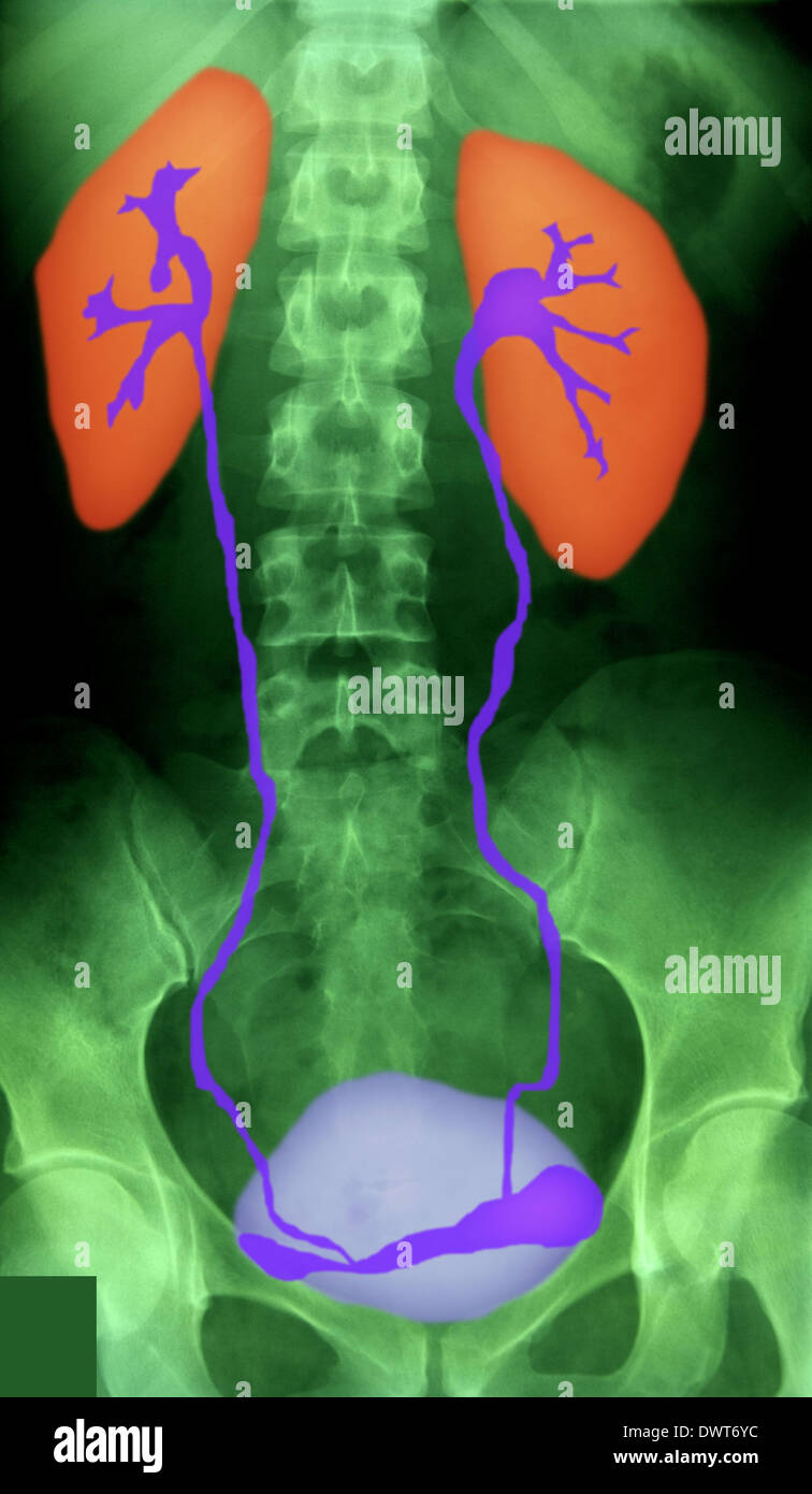 Urinary system x ray Stock Photo - Alamy