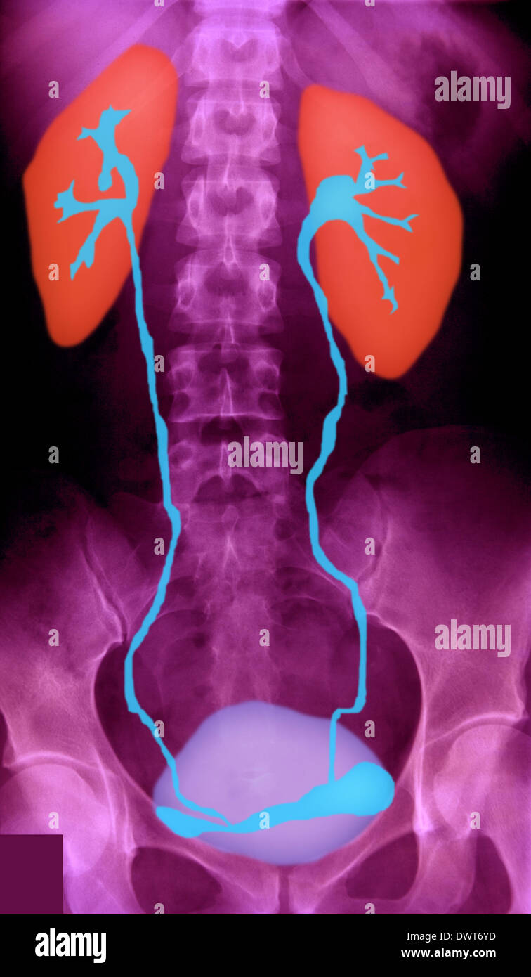 Urinary system x ray Stock Photo - Alamy