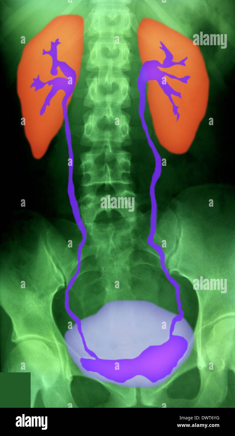 Urinary system x ray Stock Photo - Alamy