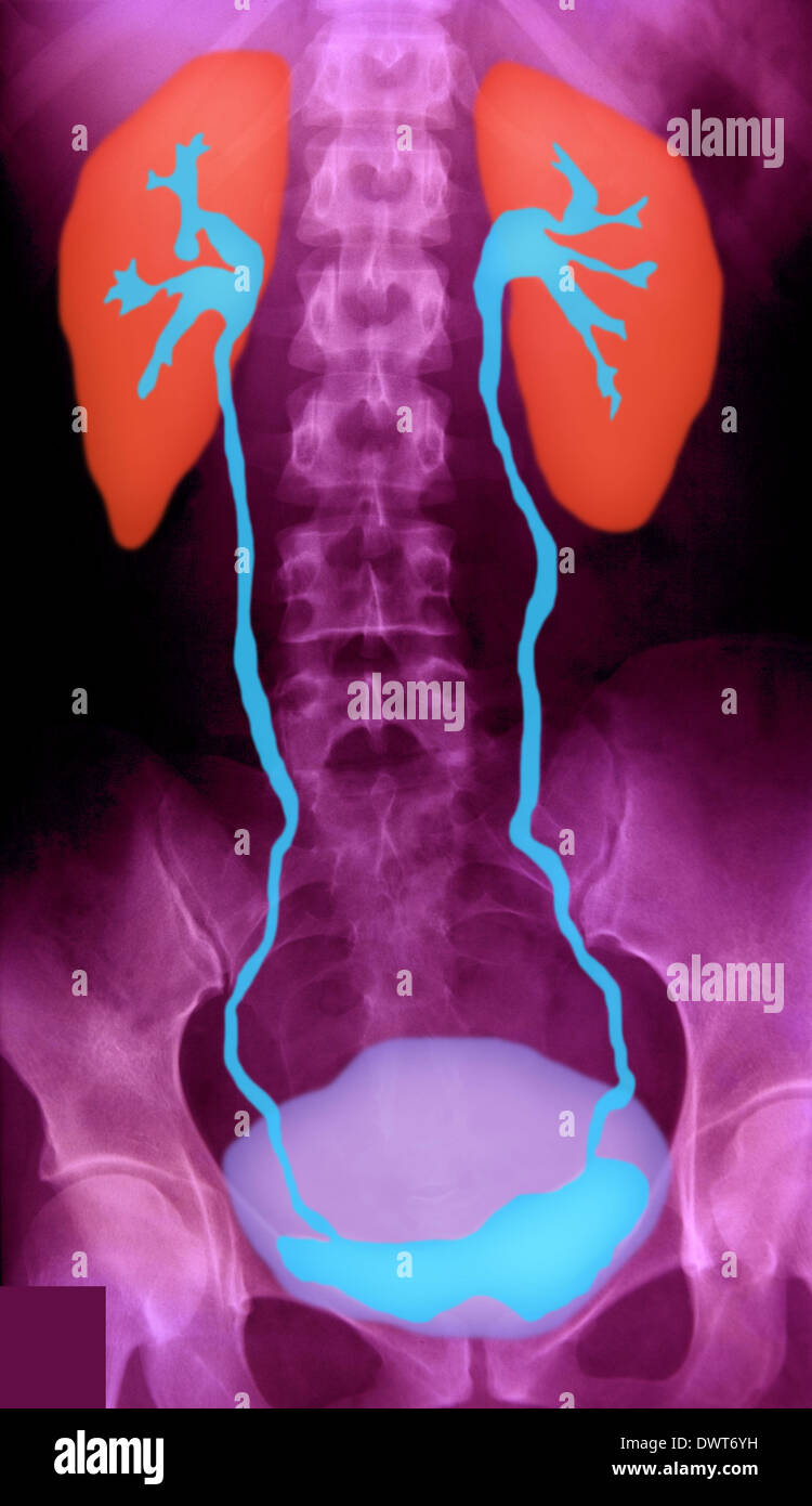 Urinary system x ray Stock Photo - Alamy