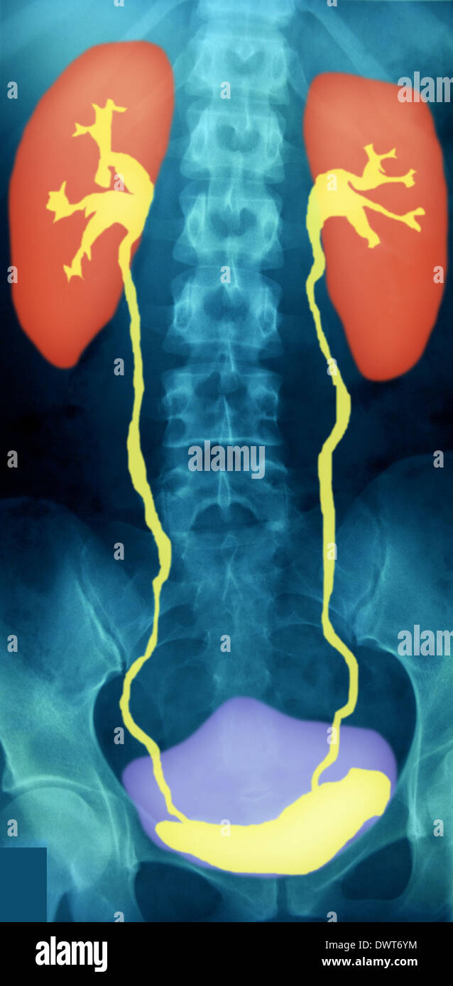 Urinary system x ray Stock Photo - Alamy