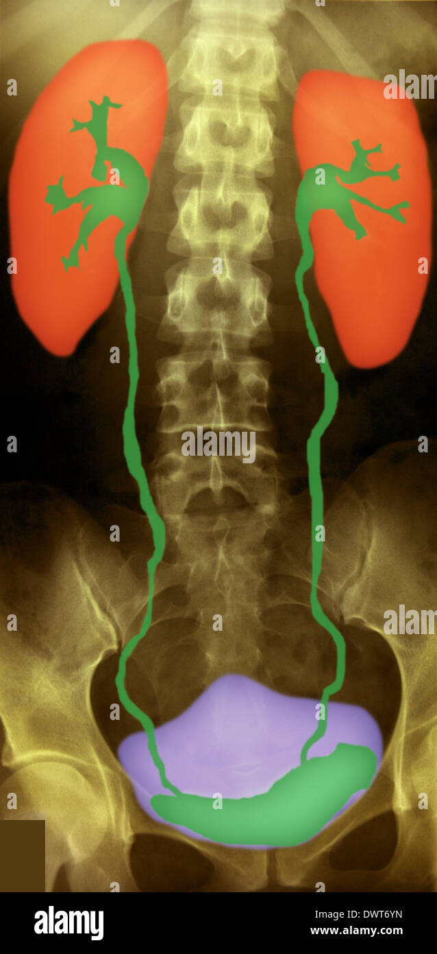Urinary system x ray Stock Photo - Alamy