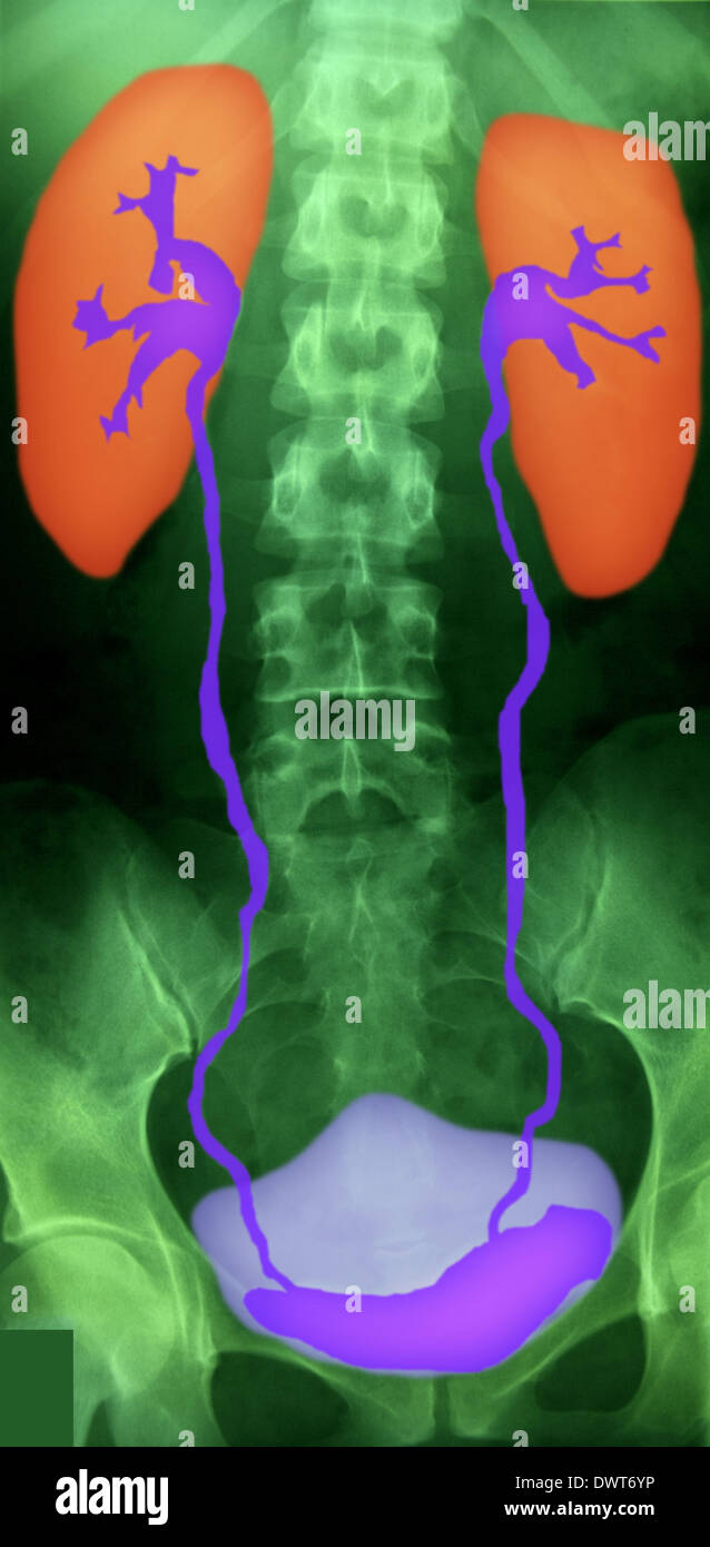 Urinary System X Ray Labeled at Oliver Goodisson blog