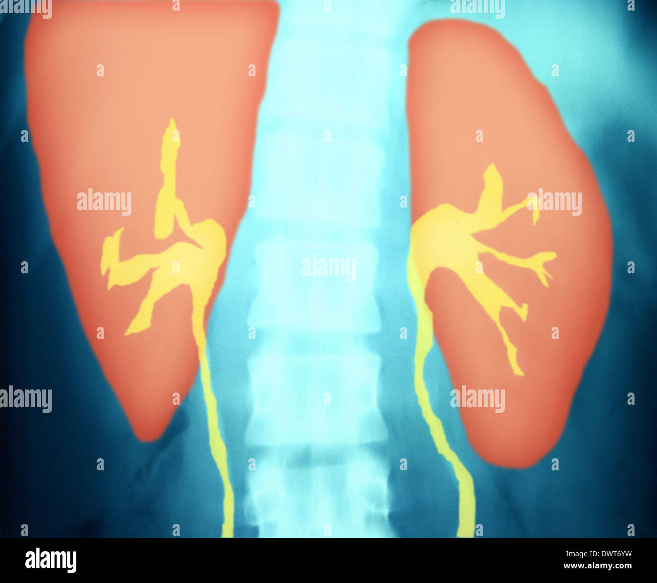 Urinary System X Ray Labeled at Oliver Goodisson blog