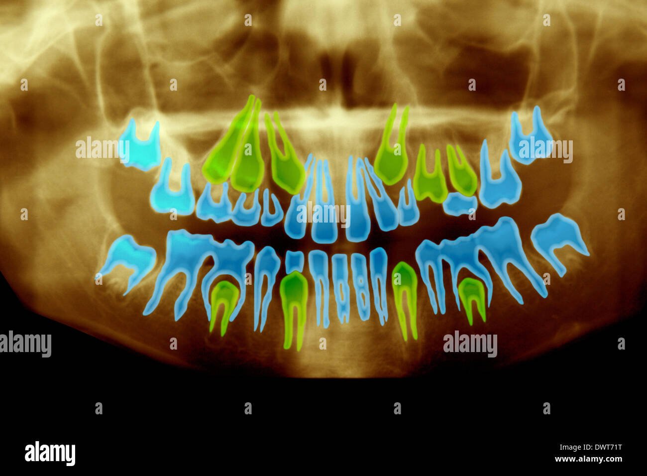 Gnathology hi-res stock photography and images - Alamy
