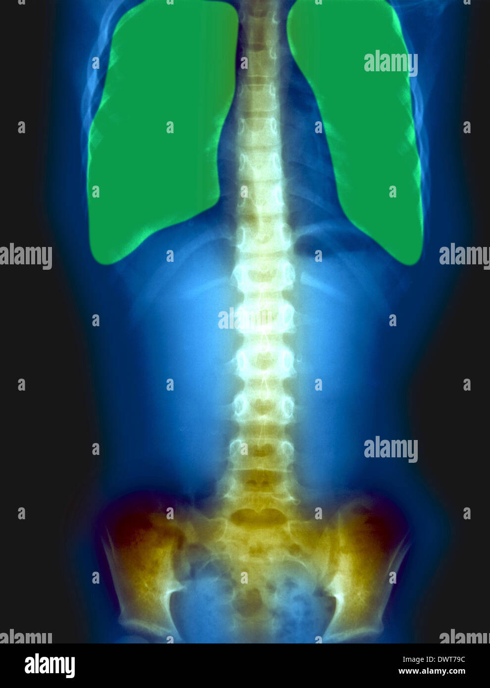 Abdomen x ray Stock Photo - Alamy
