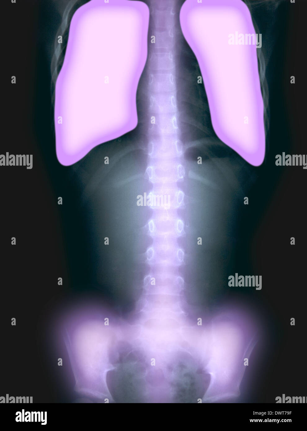 Abdomen x ray Stock Photo - Alamy