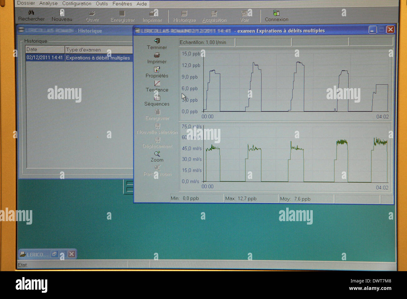Spirometry test hi-res stock photography and images - Alamy