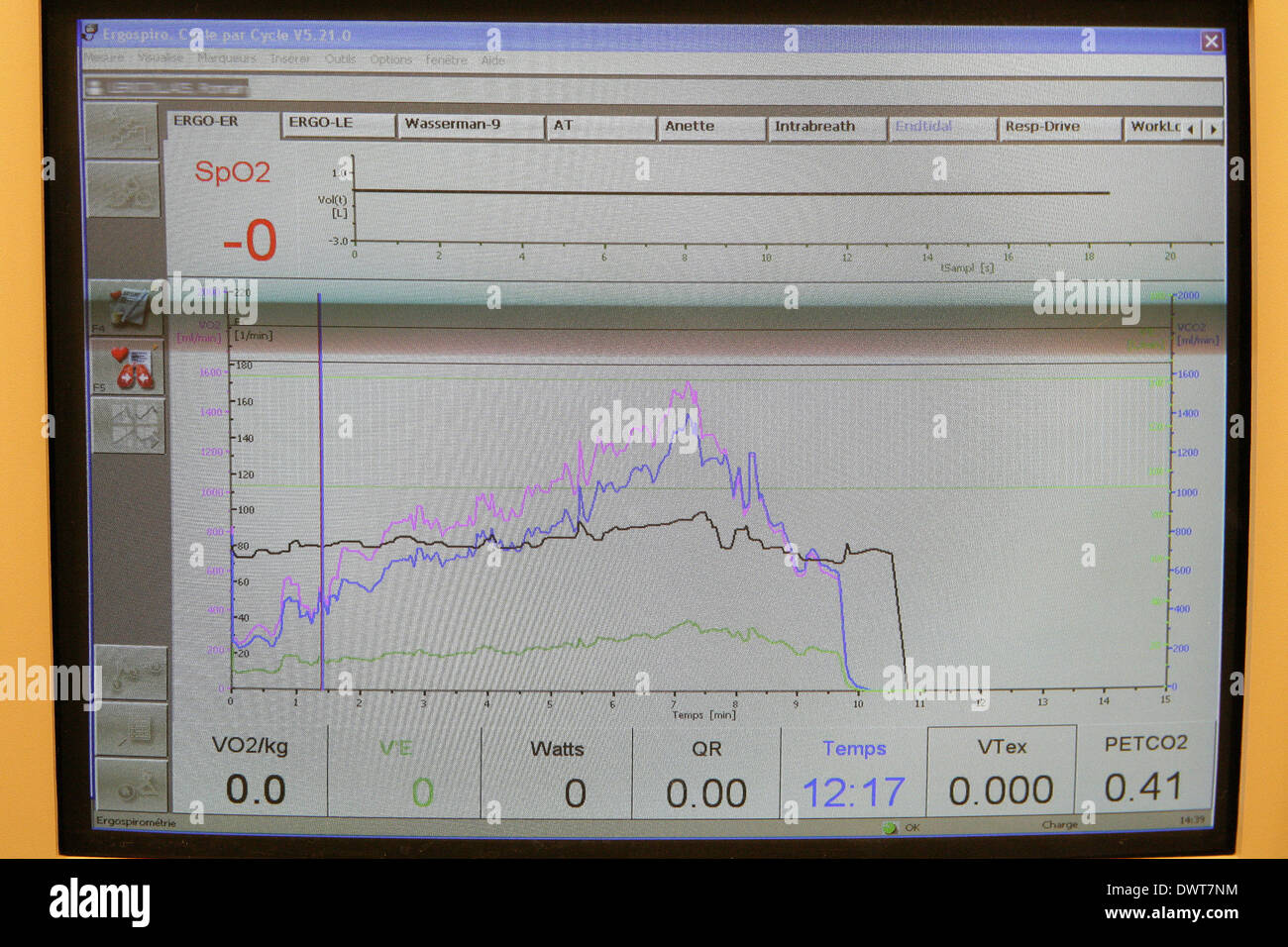 Cardiac stress test hi-res stock photography and images - Alamy