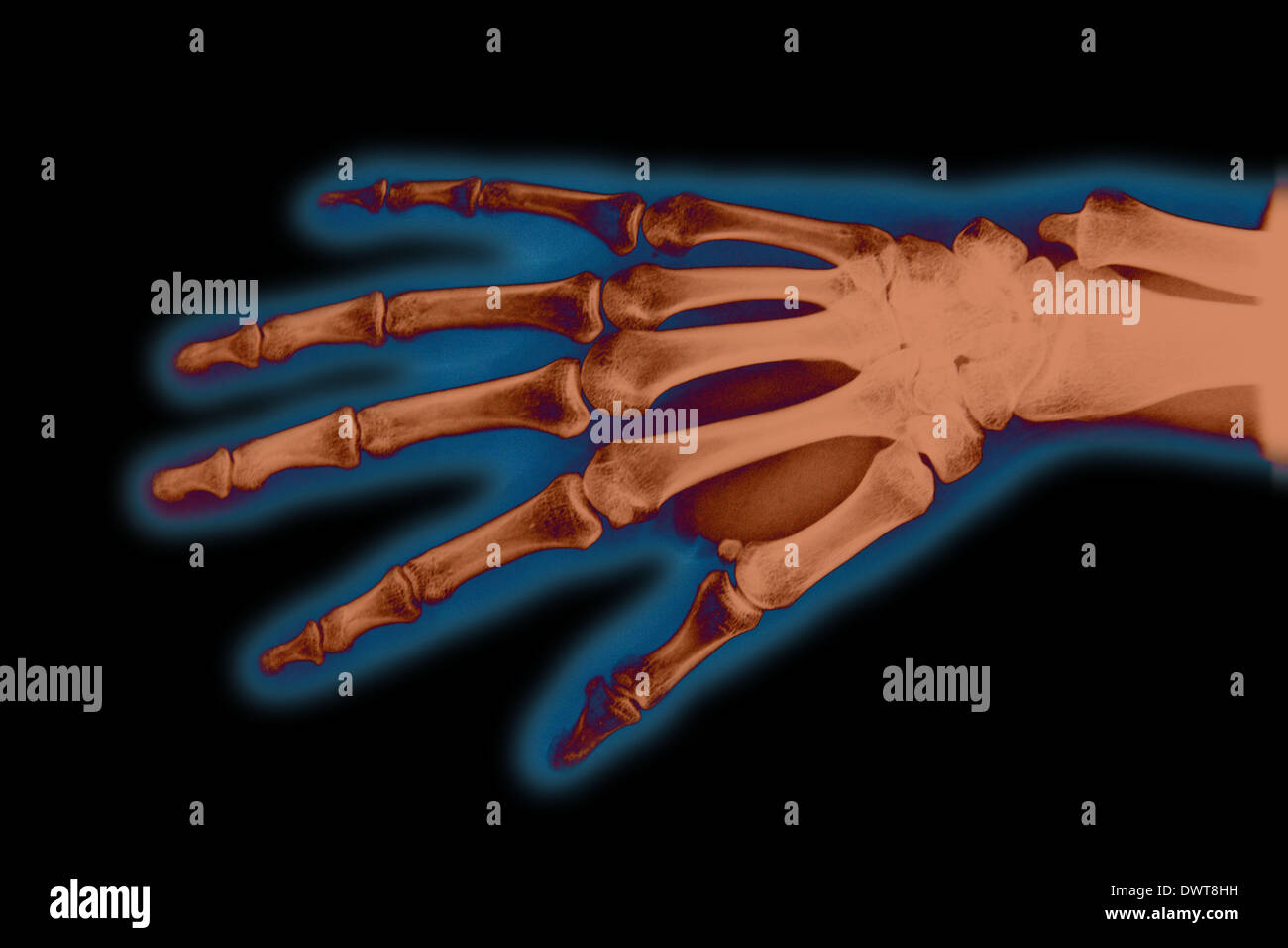 Pyramidal Bone High Resolution Stock Photography and Images - Alamy
