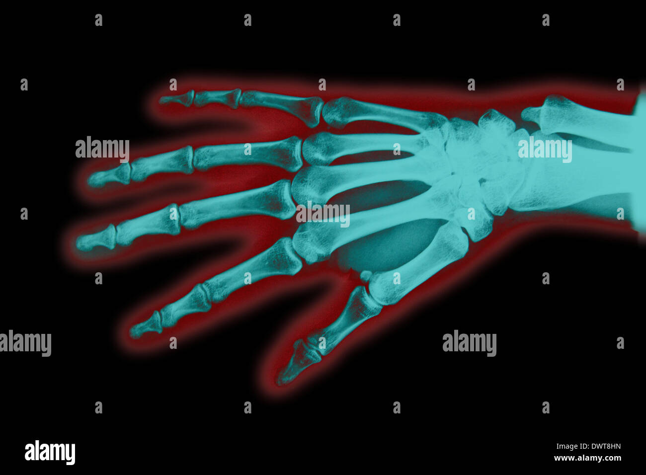 Pyramidal Bone High Resolution Stock Photography and Images - Alamy