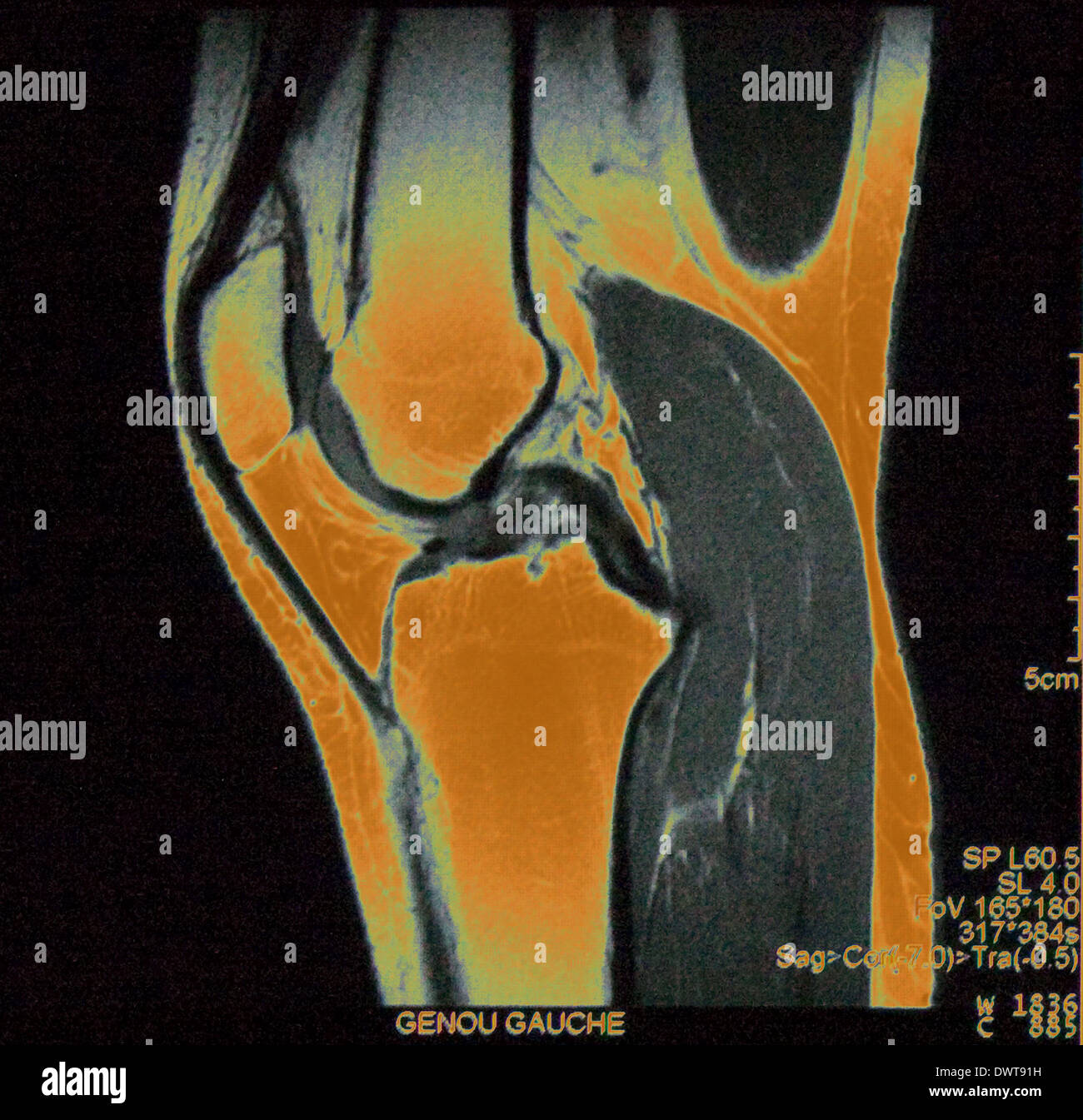Osteomuscular system hi-res stock photography and images - Alamy
