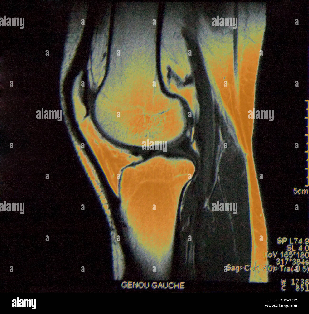 Lower limb mri hi-res stock photography and images - Alamy