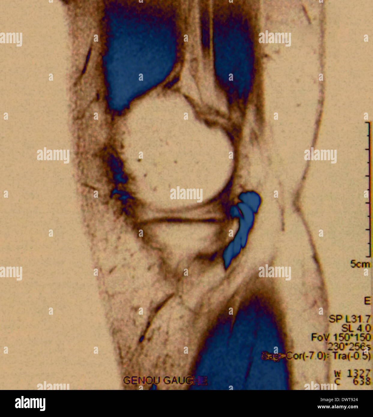 Lower limb mri hi-res stock photography and images - Alamy
