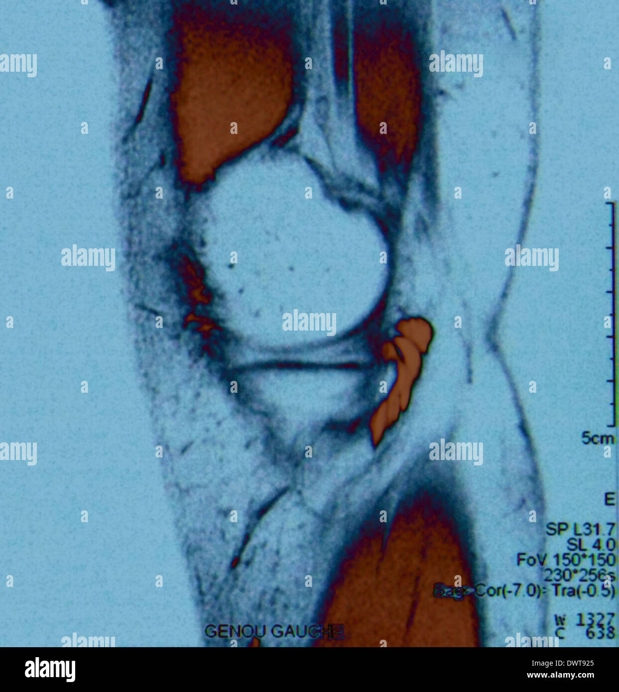 Knee mri Stock Photo - Alamy