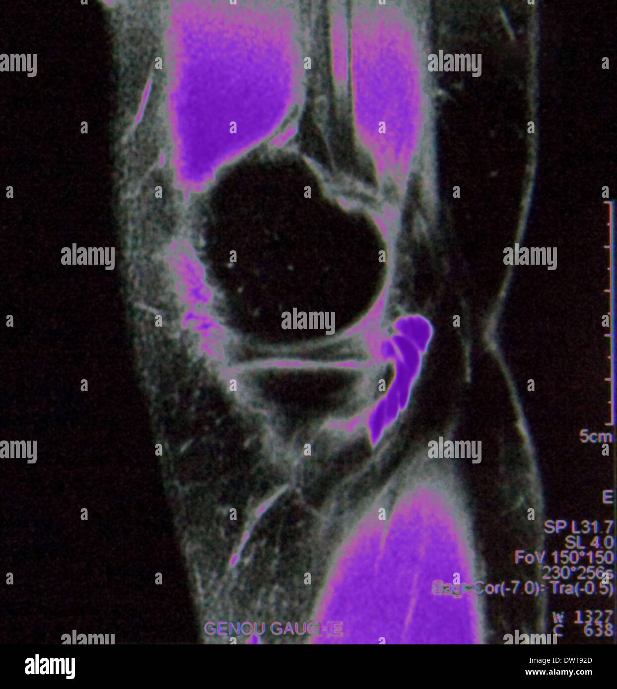 Lower limb mri hi-res stock photography and images - Alamy