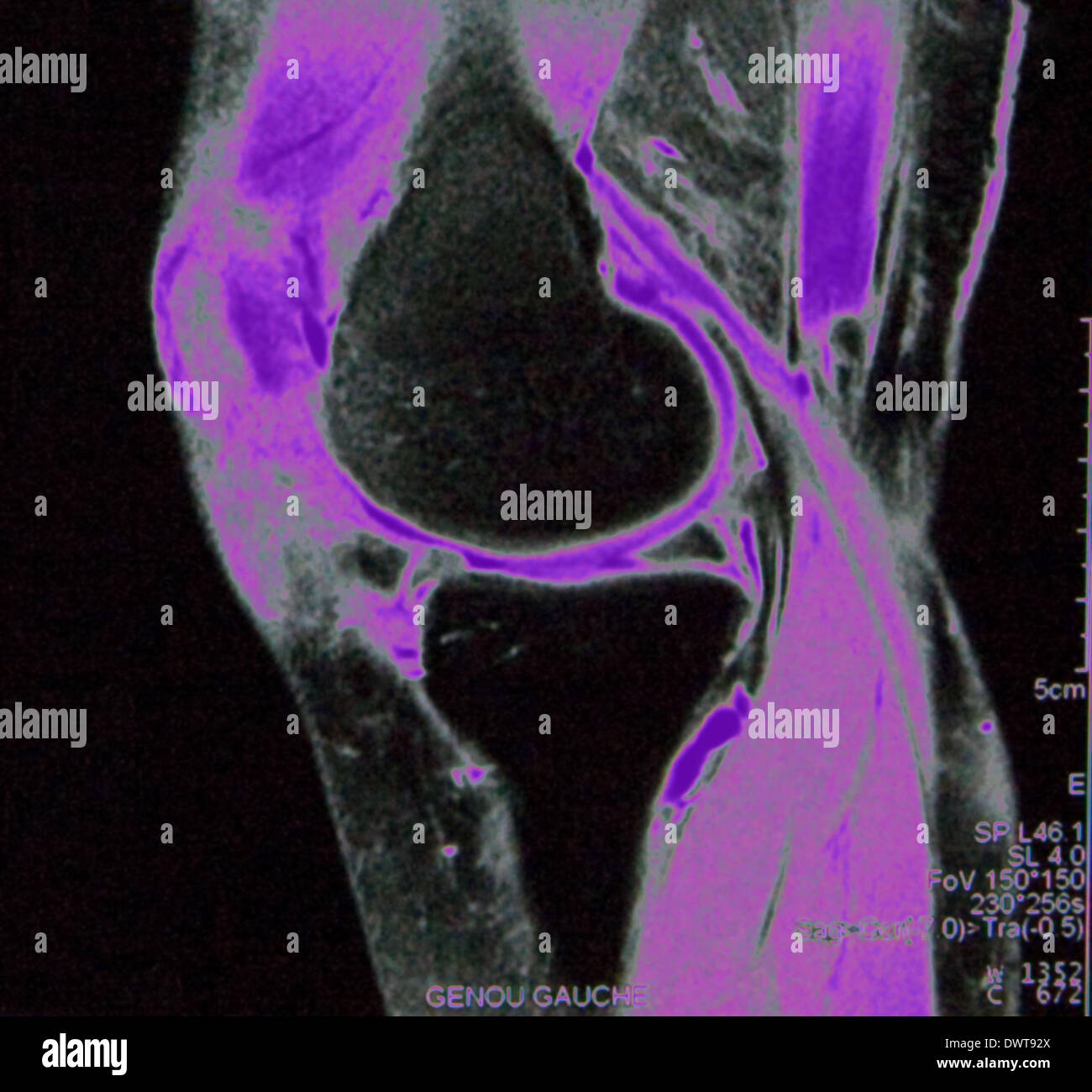 Lower limb mri hi-res stock photography and images - Alamy