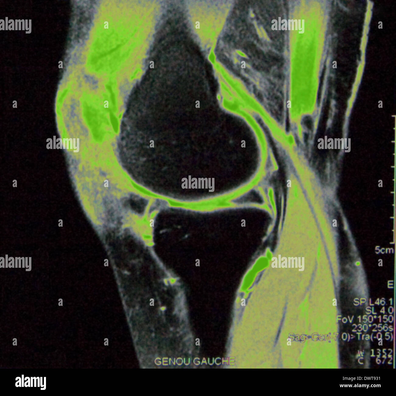 Lower limb mri hi-res stock photography and images - Alamy