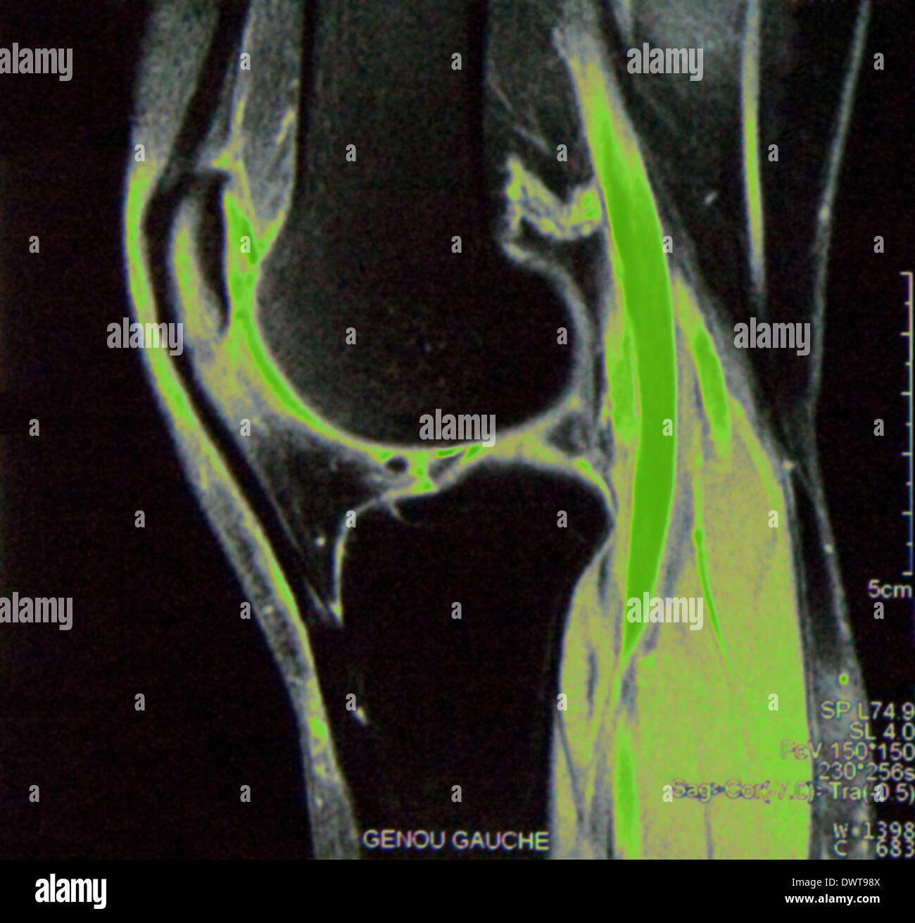Lower limb mri hi-res stock photography and images - Alamy