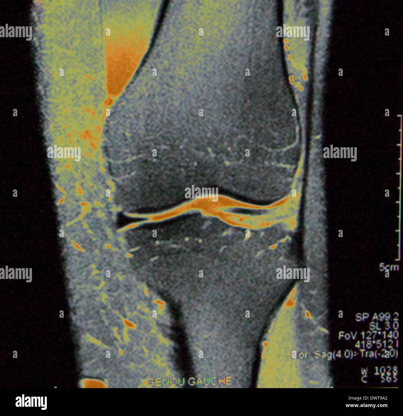 Lower limb mri hi-res stock photography and images - Alamy