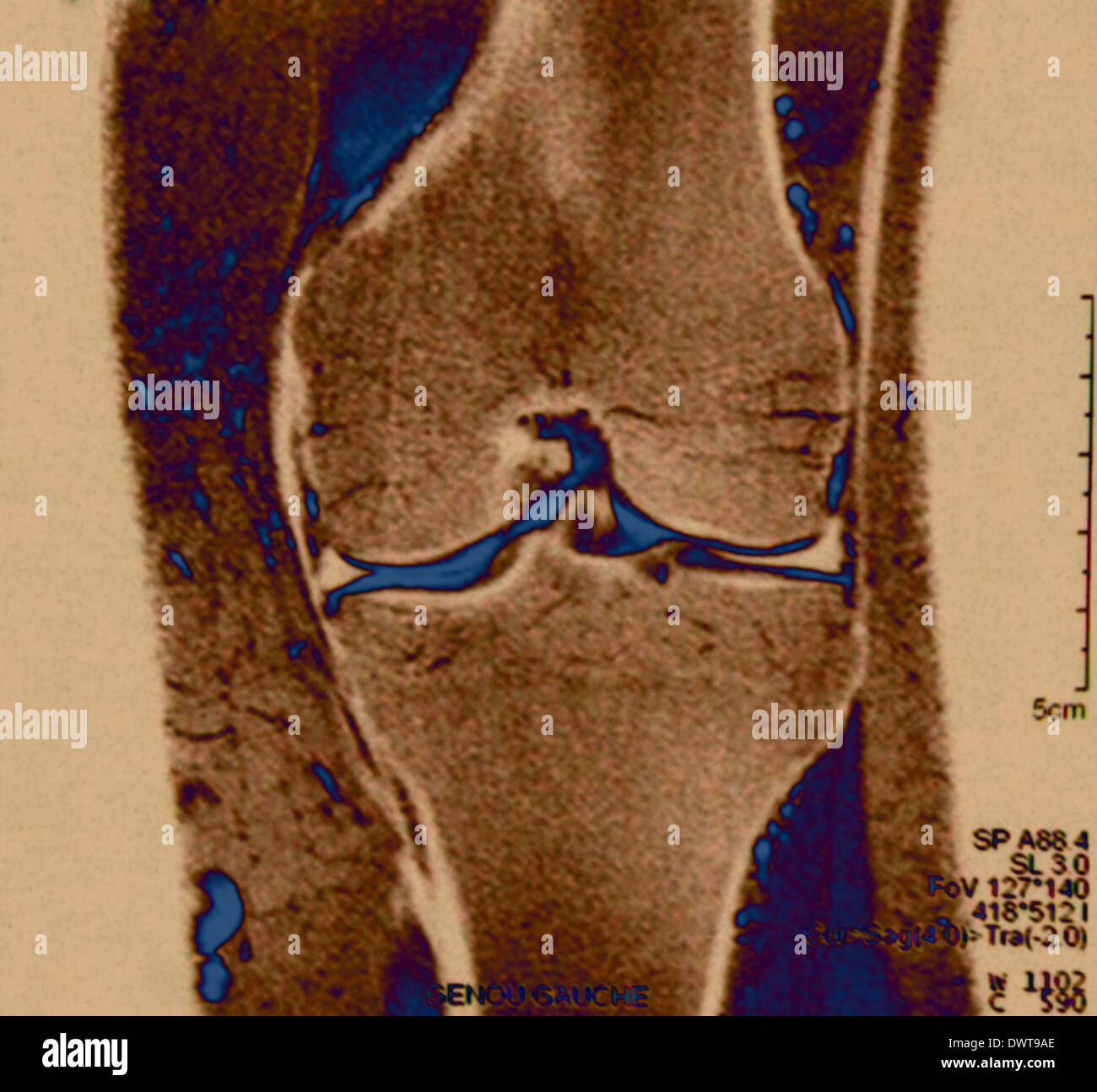 Osteomuscular system hi-res stock photography and images - Alamy