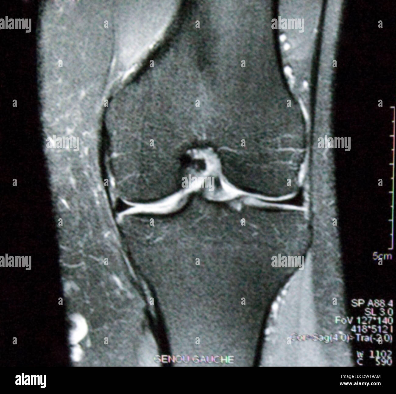Osteomuscular system hi-res stock photography and images - Alamy