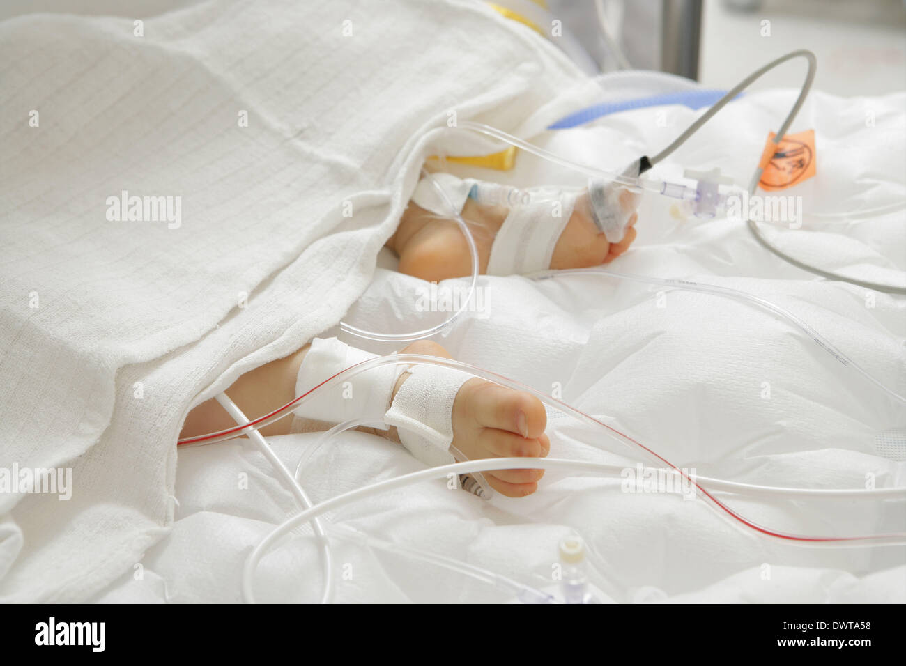 Early surgery hi-res stock photography and images - Alamy