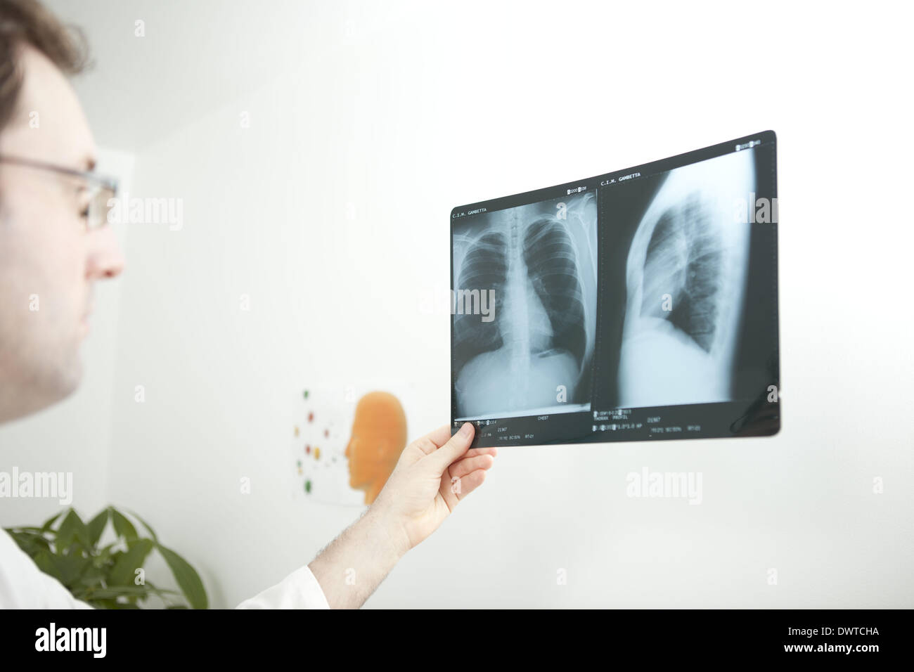 Thorax x ray Stock Photo - Alamy
