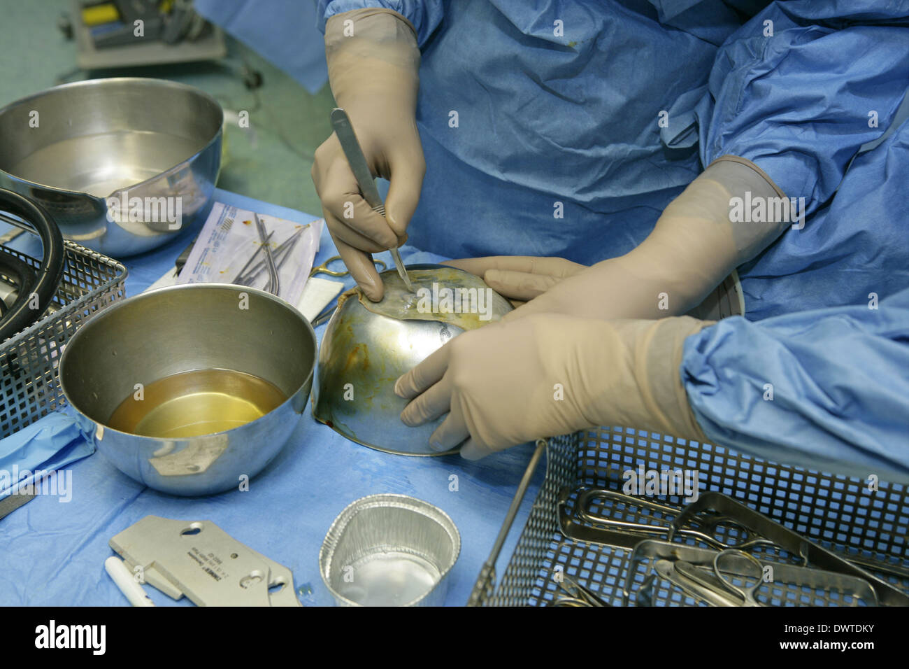 Graft skin plastic surgery hi-res stock photography and images - Alamy