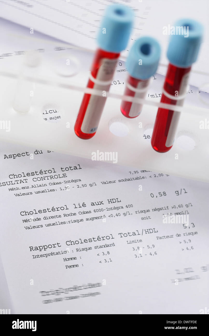 Lipid analysis hi-res stock photography and images - Alamy