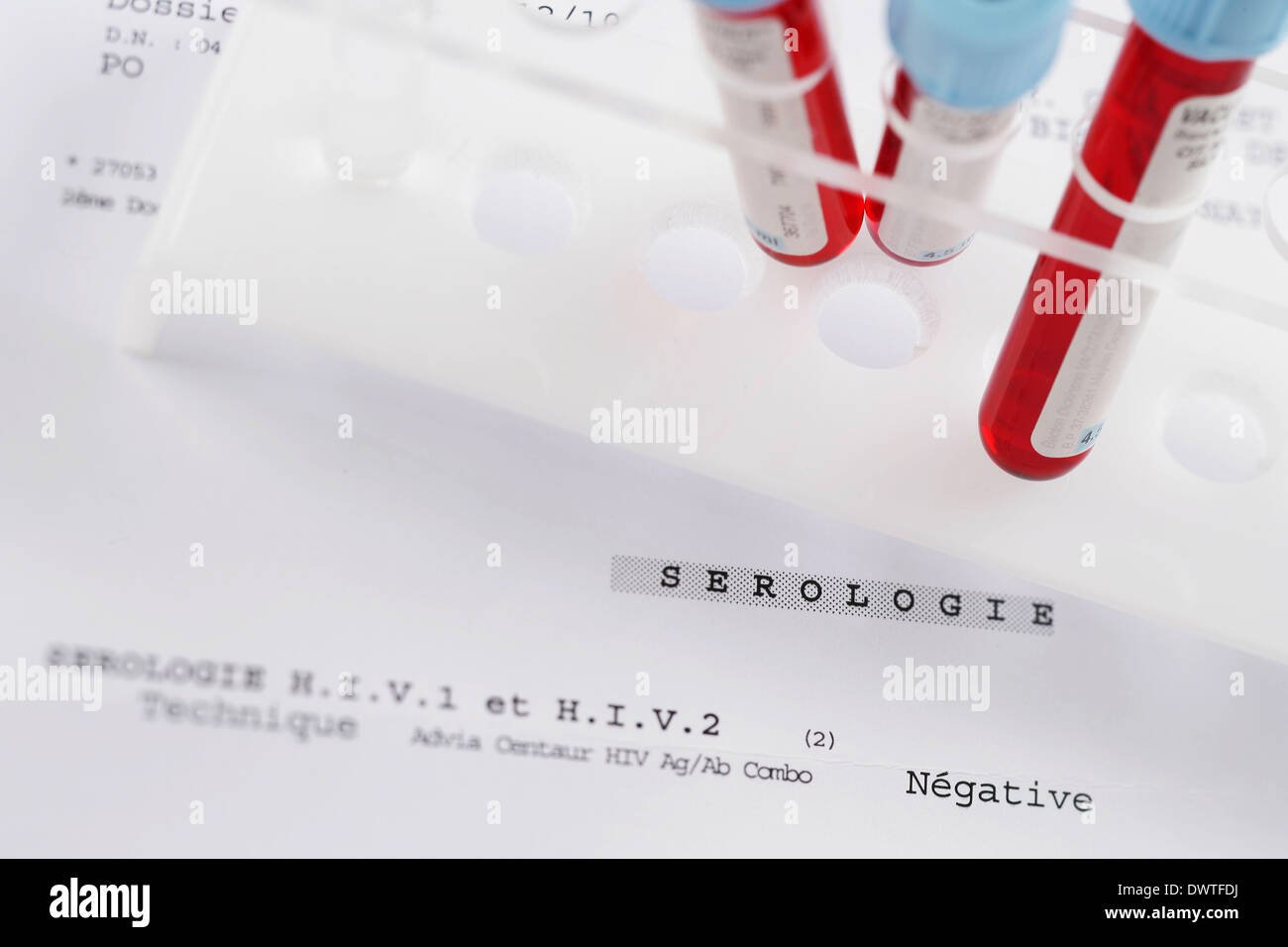 Sexually transmitted infection sti screening hi-res stock photography ...