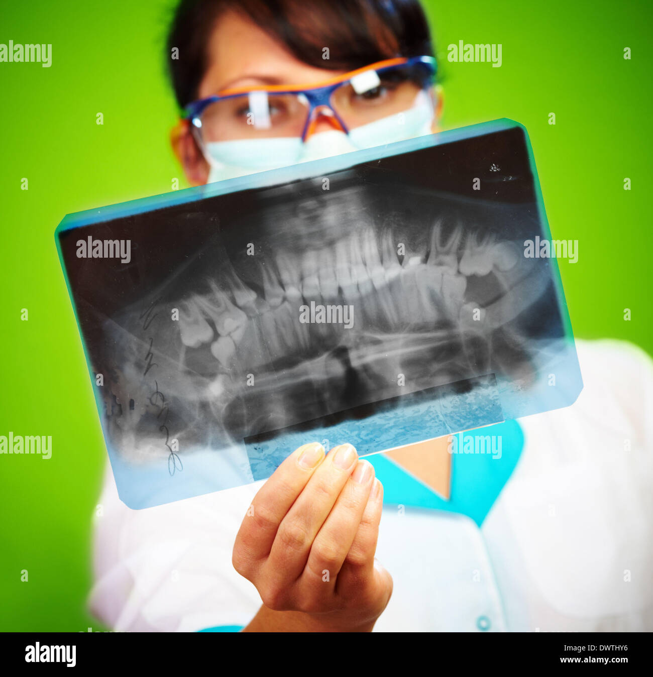 Medical examination radiography Stock Photo - Alamy