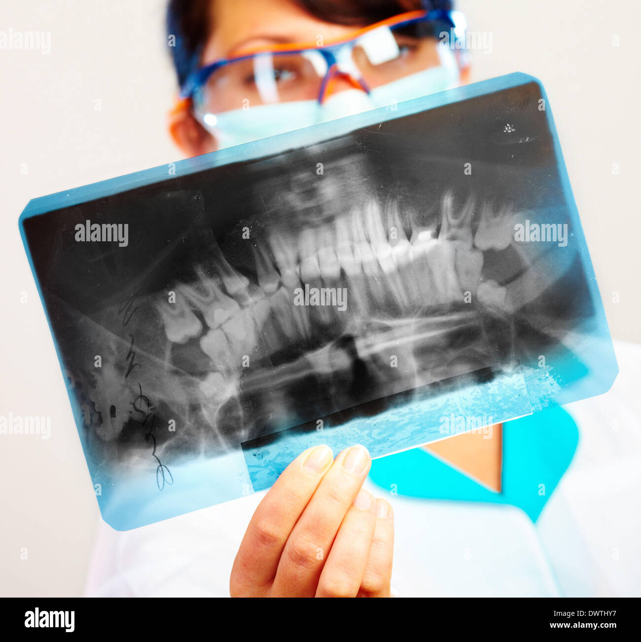 Medical examination radiography Stock Photo - Alamy