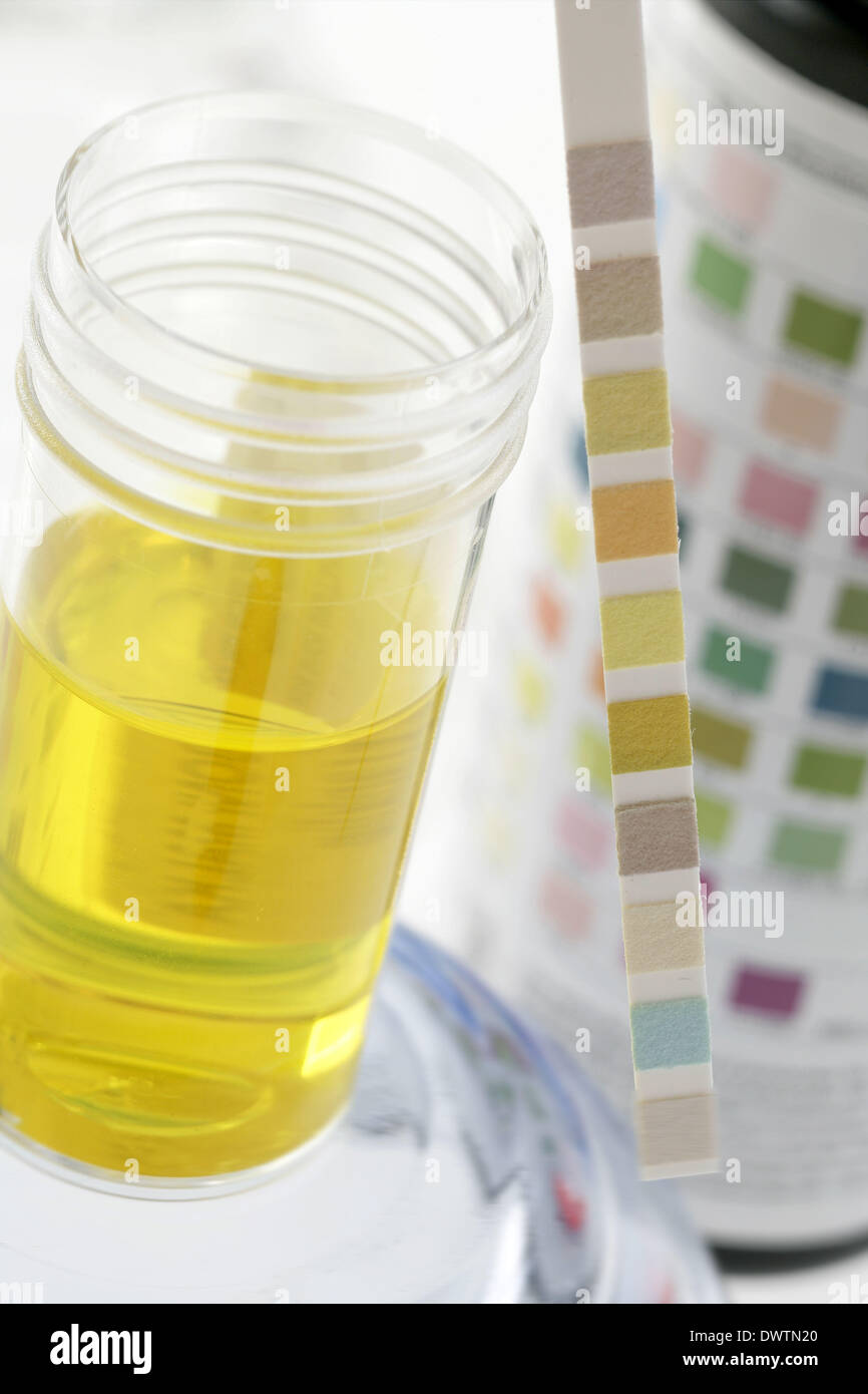 Urine test strip Stock Photo - Alamy