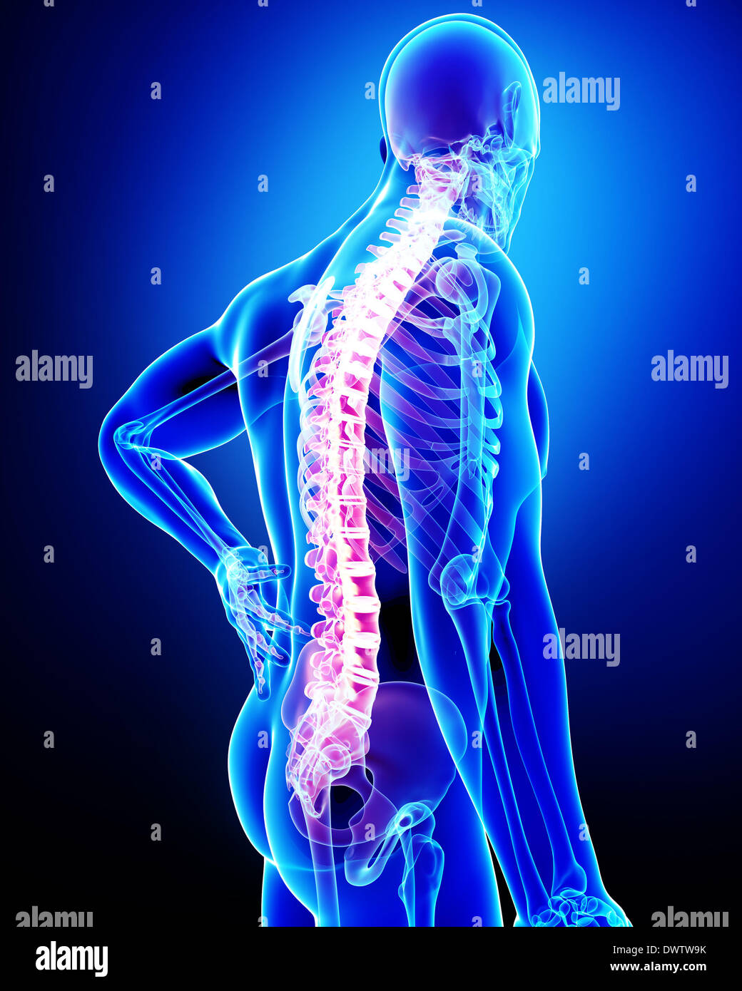 Back pain man drawing hi-res stock photography and images - Alamy