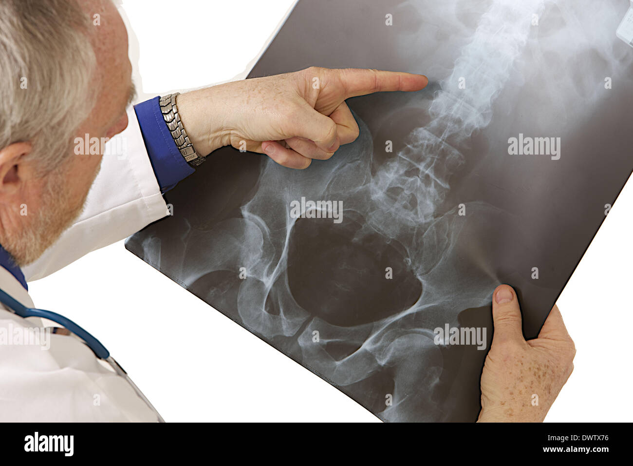 Medical examination radiography Stock Photo - Alamy